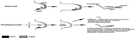 How Does Thalidomide Induce Phocomelia Download Scientific Diagram