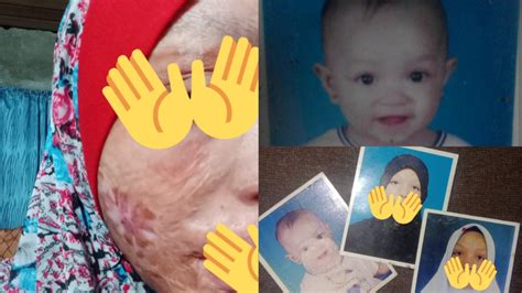 Gadis Ini Viral Curhat Sering Menangis Di Depan Cermin Karena Luka