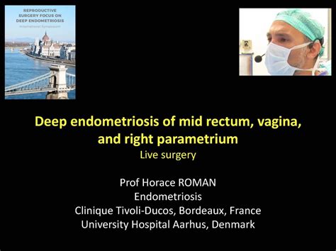 Live Surgery To Budapest Disc Excision In Deep Endometriosis Of Low Rectum Vagina And Parametrium