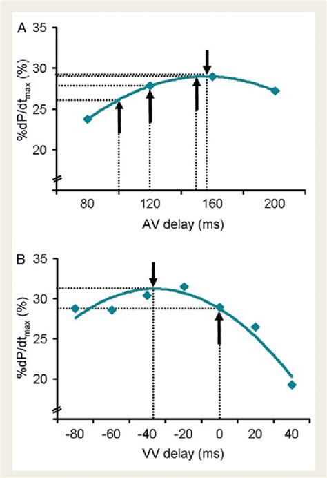 Illustrative Atrioventricularinterventricular Delay Optimization Download Scientific Diagram