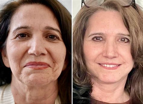 Dr Juan Cuellar Obesity Control Center