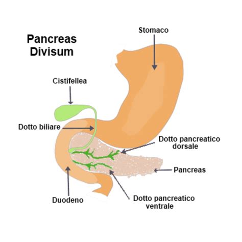 Pancreas Divisum Wikiwand