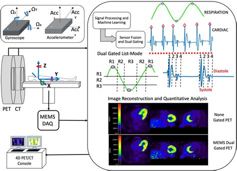 Digital Health Technology Group Mems Based Intrafraction Motion