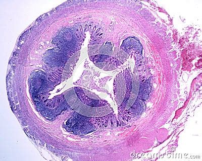 Human Vermiform Appendix Royalty Free Stock Photo CartoonDealer Com