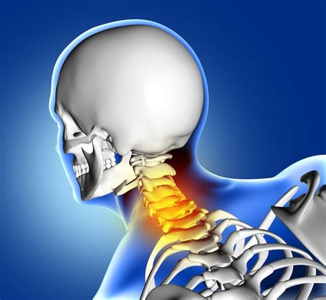 Скелет Шеи Фото – Telegraph