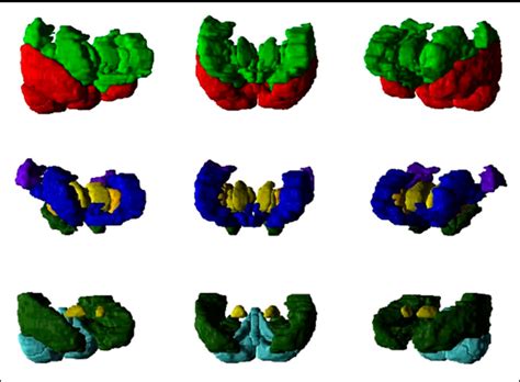 Figure 1 From Evaluation Of Atlas Based Attenuation Correction For