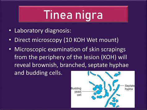 Tinea Nigra Hortaea Werneckii Ppt Pptx