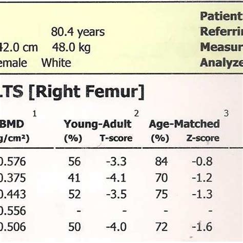 4 A Dxa Image Of Right Proximal Femur Of 80 Years Old Osteoporotic
