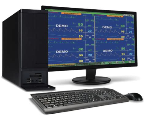 Central Monitoring System Ibsgroupe