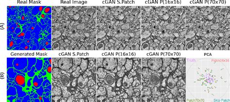 Figure 1 From Gan With Skip Patch Discriminator For Biological Electron Microscopy Image