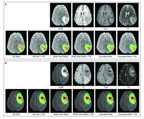 Examples Of Test Time Augmentation Tta Combined With Different Cnns