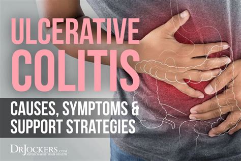 Ulcerative Colitis Causes Symptoms And Natural Support Strategies
