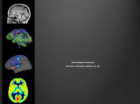 Pptx Neuroimaging Processing Overview Limitations Pitfalls Etc