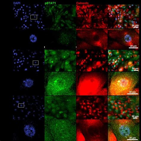 Pdf Inhibition Of Jak Stat Pathway Corrects Salivary Gland