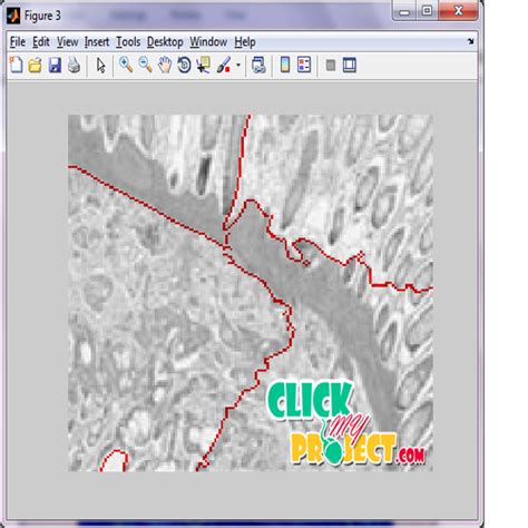 Multilevel Segmentation Of Histopathological Images Using Co Occurrence Of Tissue Objects
