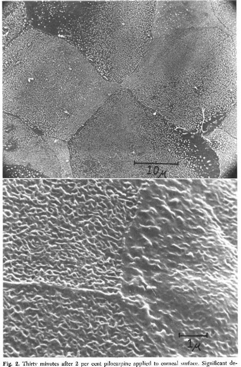 Phospholine Iodide Semantic Scholar