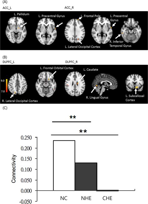 Differences In The Functional Connectivity Within The Cognitive Control