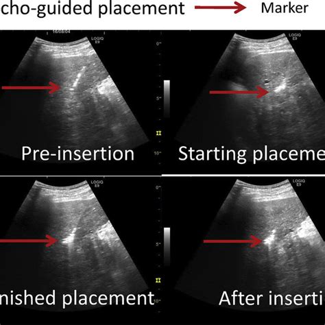 E Ct And Mr Images Ct And Mri Comparisons Of 3 Representative Mri