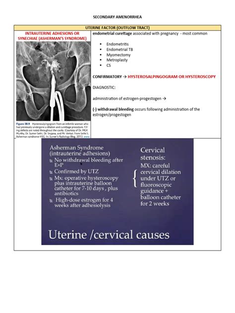 Secondary Amenorrhea Pdf Luteinizing Hormone Menstrual Cycle