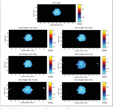 Figure From Vector Quantization Of RF Channel Data For Ultrasound Imaging Semantic Scholar