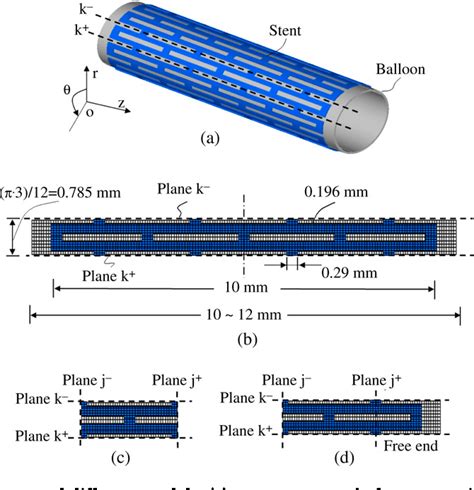 Figure 2 From On The Finite Element Modelling Of Balloon Expandable Stents Semantic Scholar