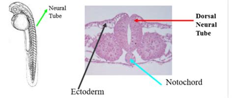 The Neural Crest Flashcards Quizlet