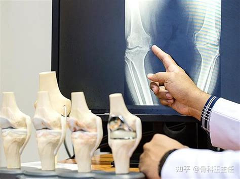 机器人做膝关节置换手术，有什么好处和坏处？ 知乎
