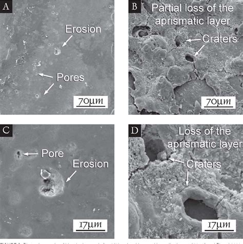 Figure 1 From Evaluation Of The Bleached Human Enamel By Scanning Electron Microscopy