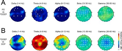 Scalp Topography Of Relative Eeg Power In Pd Patients With Depression
