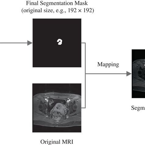 results of single modality mri segmentation evaluation a dsc values