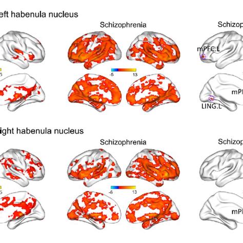 Within Group Patterns And Between Group Differences Of The RSFC For Download Scientific