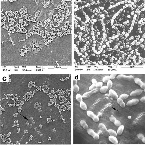 Field Emission Scanning Electron Microscopy Of Biofilm Producing