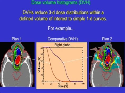 dose volume histogram