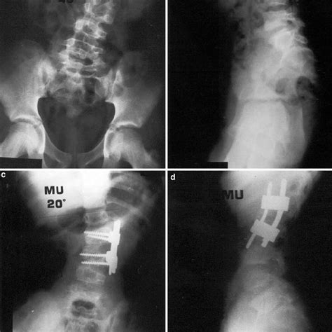 Classification Of Formation Deficiency A Unincarcerated Fully
