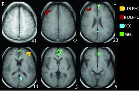 Figure 1 From Functional Connectivity Between Task Positive And Task
