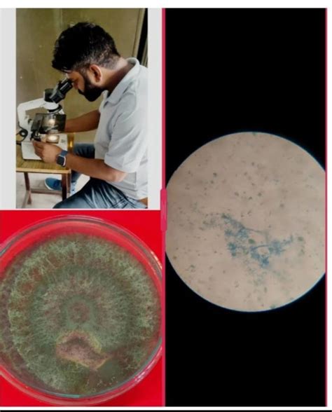 Mukesh Prajapati On Linkedin Identifying Trichoderma Harzianum In Oyster Mushrooms Involves