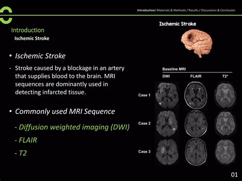Deep Learning Based Fully Automated Detection And Quantification Of Acute Infarcts Ppt