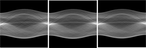 Comparison Of The Noised Left Denoised Middle And Noise Free