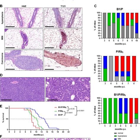 Development And Characterization Of Mammary Cancer Models A Oncoprint Download Scientific