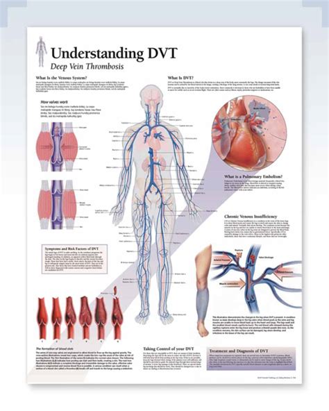 Understanding Dvt Exam Room Anatomy Poster Clinicalposters