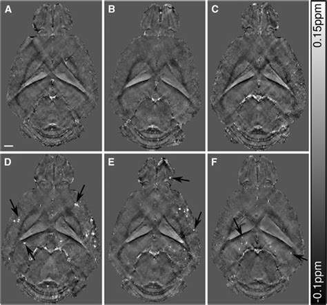 Horizontal Quantitative Susceptibility Maps Of Three 18 Month Old