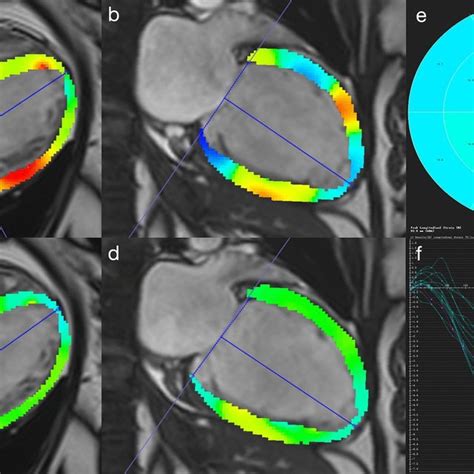 Deep Convolutional Generative Adversarial Network Dcgan Architecture Download Scientific Diagram