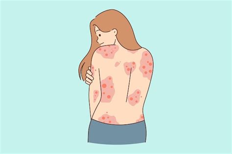Premium Vector Unhealthy Woman Show Red Rash On Back