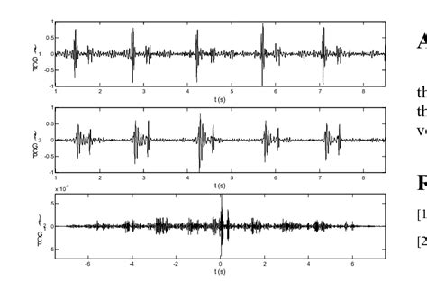 A Demonstration Of Pcg Signals Measured And Its Crosscorrelation