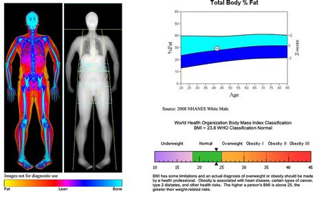 A Case For DEXA Scans In Clinical Measurement Of Body Composition