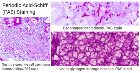 Staining Notes Microbe Notes