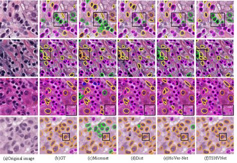 Github Jia Yang Btshvnet