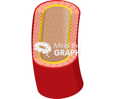 Vascular Smooth Muscle Cells