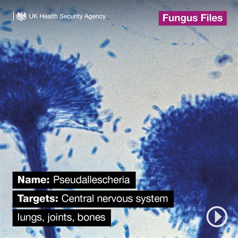 Inside Britains Deadly Fungus Collection The Online Pharmacy