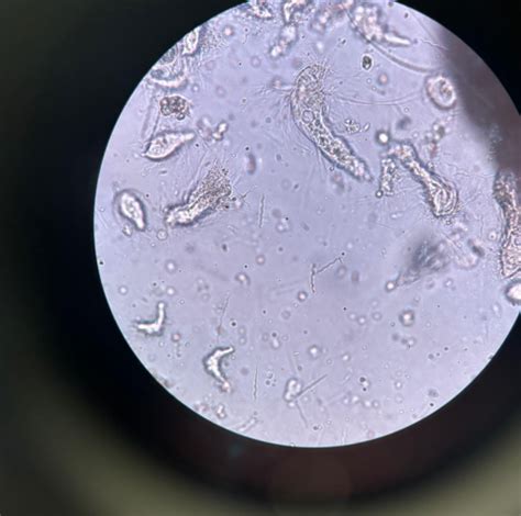 Lab Practical 1 Protists Flashcards Quizlet